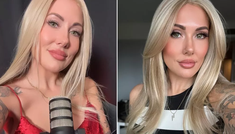 Carly Electric: La modelo que sobrevivió a un rayo y despertó con ojos ...